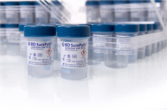 The BD SurePath™ Liquid-based Pap Test provides advantages | BD